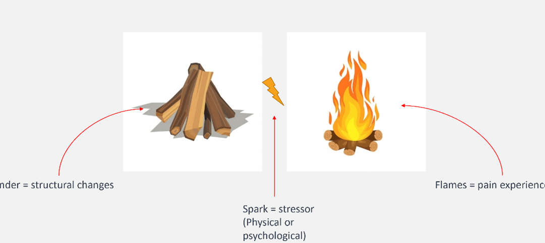 Pain spark to fire analogy - Star Physio. Expert Physiotherapy Care.